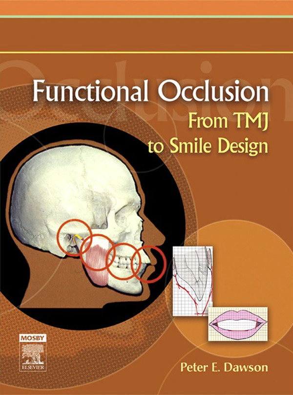 Functional Occlusion E Book Frohberg
