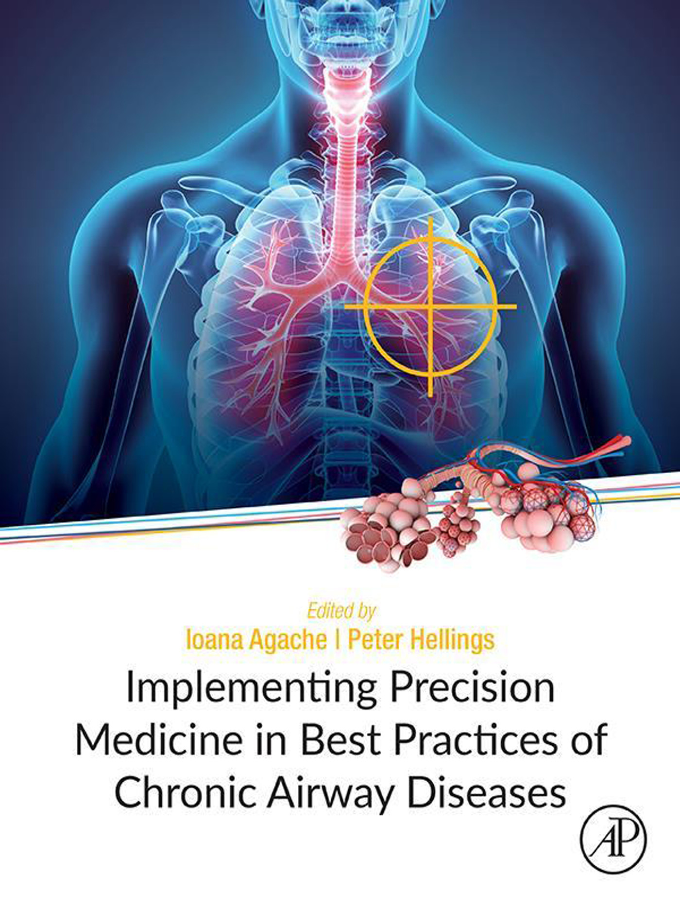 Implementing Precision Medicine in Best Practices of Chronic Airway ... Implementing Precision Medicine in Best Practices of Chronic Airway ...